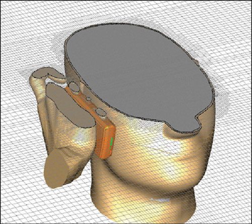 Human Exposure to Mobile Phone EM Radiation