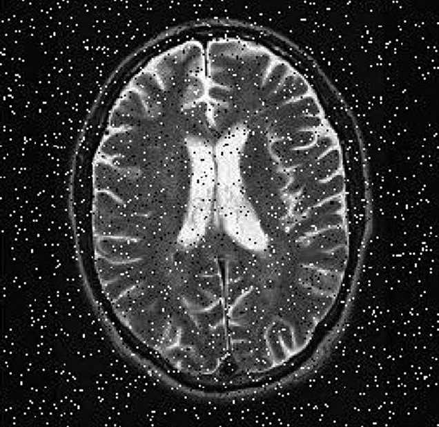 Image Processing Using MATLAB: Spatial Filtering