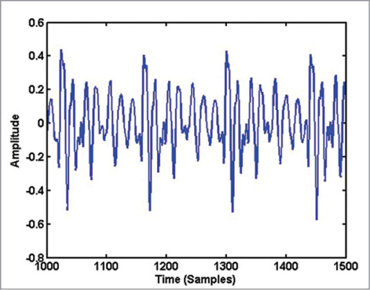Understanding Spectrogram of Speech Signal Using MATLAB