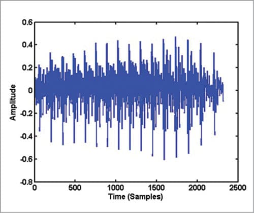 Understanding Spectrogram of Speech Signal Using MATLAB