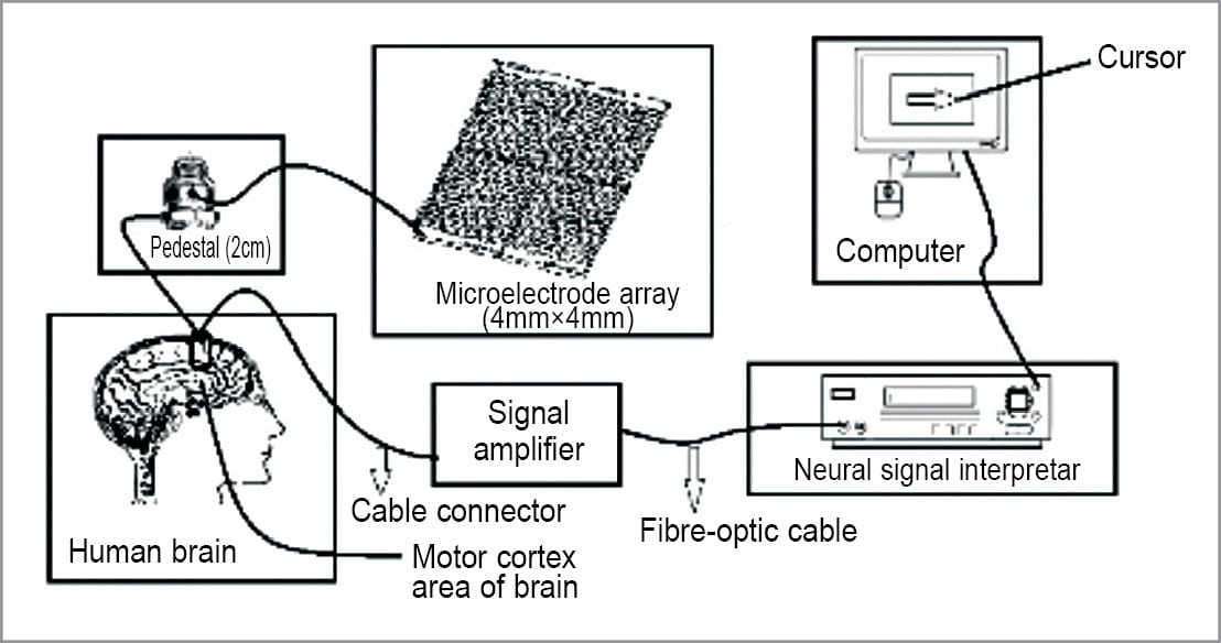 Brain Gate: Assistive Technology for Productive Living