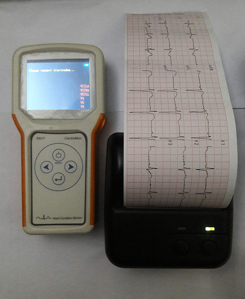 CardioMon - Saving Lives Through ECG at Home | Medcal Electronics