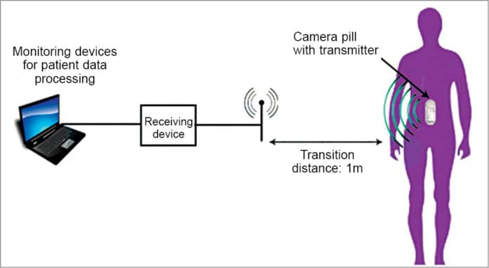 Electronic Pill: The Holy Grail Of Healthcare Technology