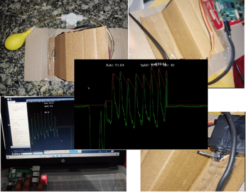 COVID -19 Ventilator and Health Monitoring Device | Full DIY Project