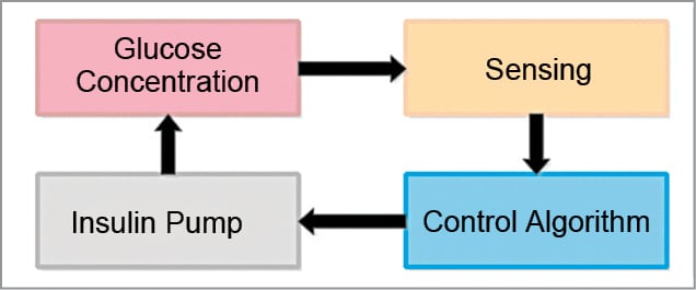 Artificial Pancreas: An Engineering Revolution In Healthcare