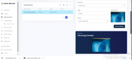 X-Ray-Based Quick COVID-19 Detection With Raspberry Pi