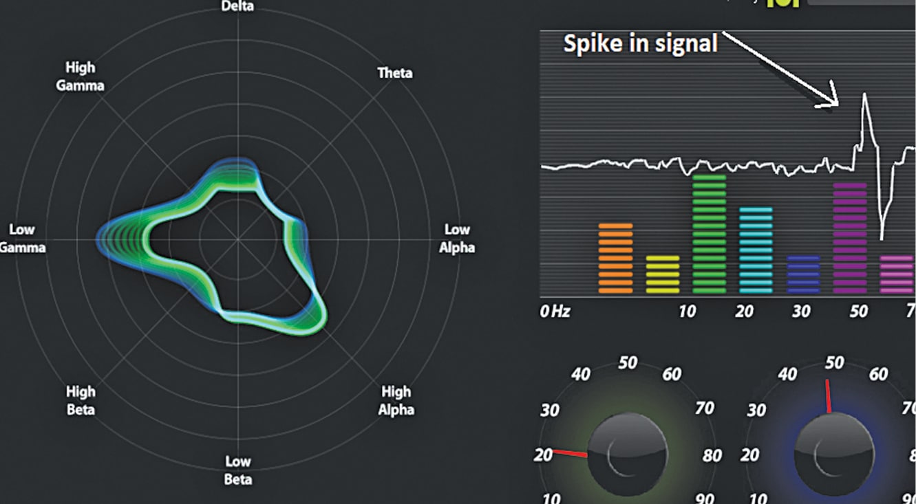 Mind Controlled Prosthetic Arm | Full Electronics Project