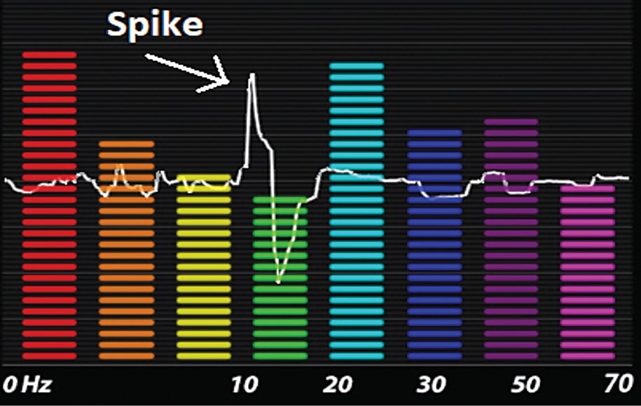 Mind-Controlled Prosthetic Arm | Full Electronics Project - Be Yourself ...