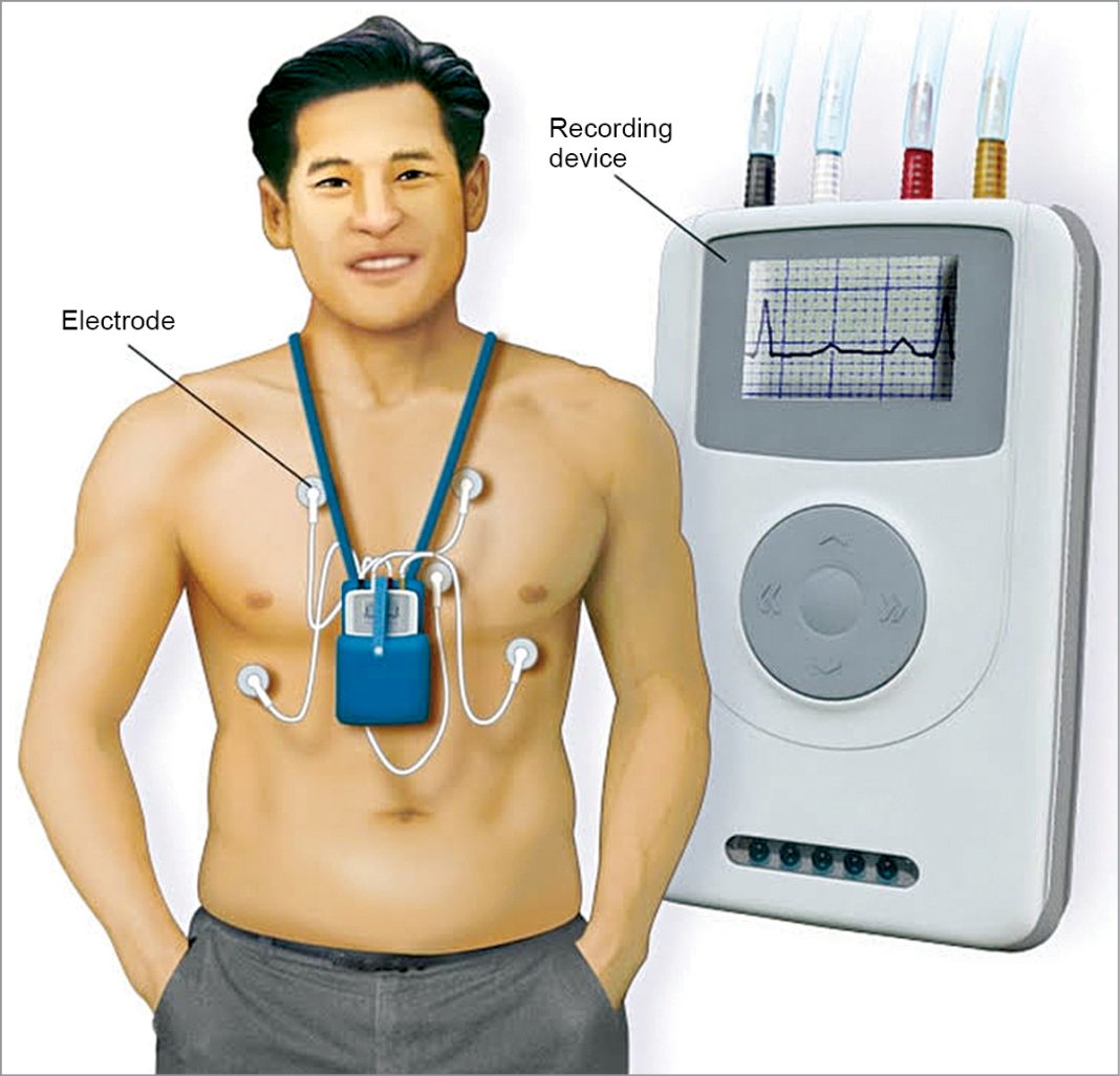 Remote Monitoring Of Cardiac Devices