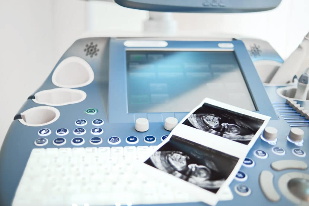 Non-Invasive Monitoring Of Placenta During Pregnancy - Electronics For You