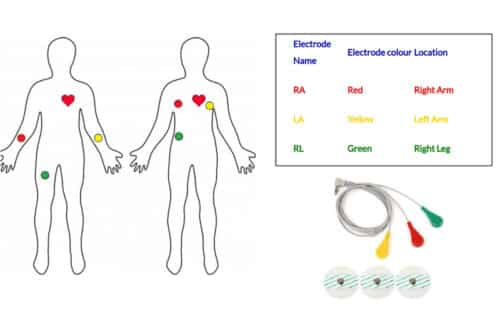 Real Time Handheld ECG Display