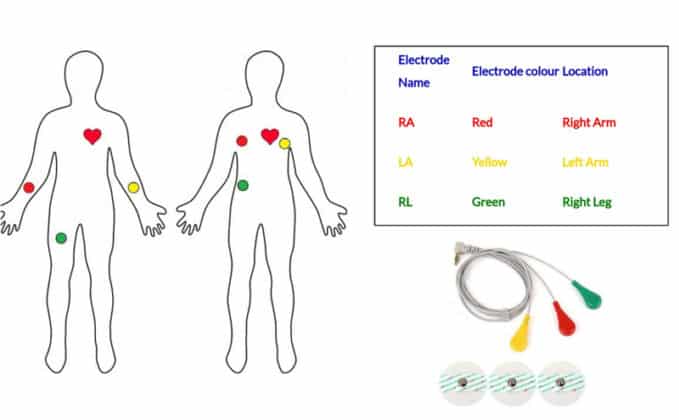 Real Time Handheld ECG Display