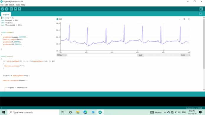 Real Time Handheld ECG Display