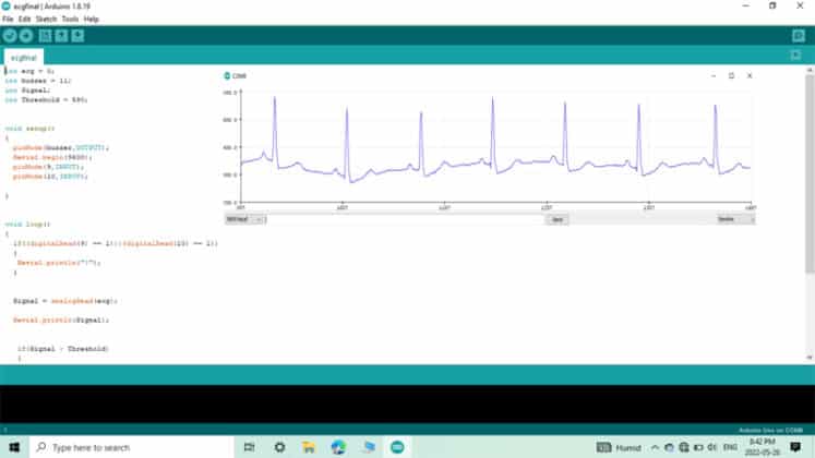 Real Time Handheld ECG Display