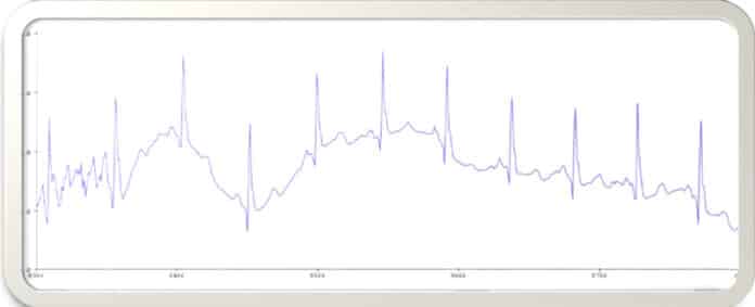 Real Time Handheld ECG Display