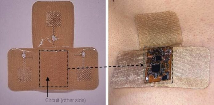 Screen Printing Stretchable Electronic Devices