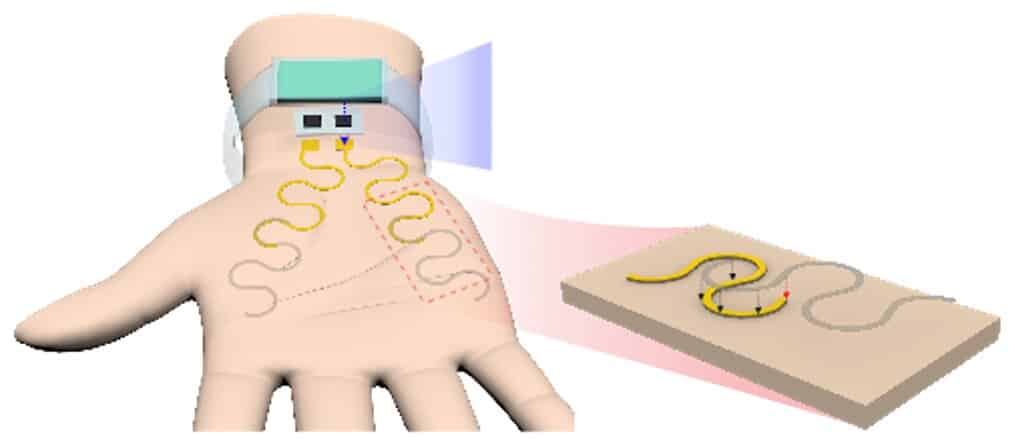 Tracking Emotions Using An Electronic Tattoo