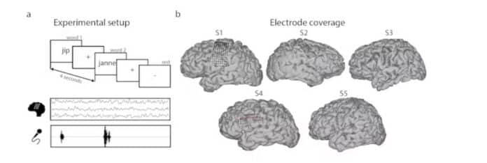 Brain Implants Transformed Thoughts Into Speech