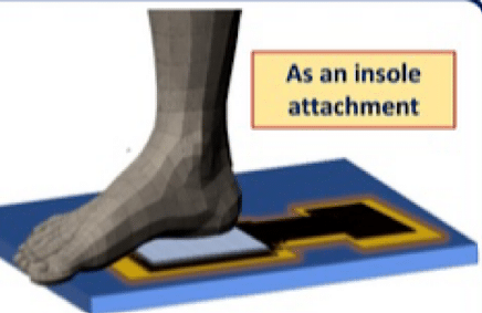 New Wearable Pressure Sensor For Postural Deformity Monitoring