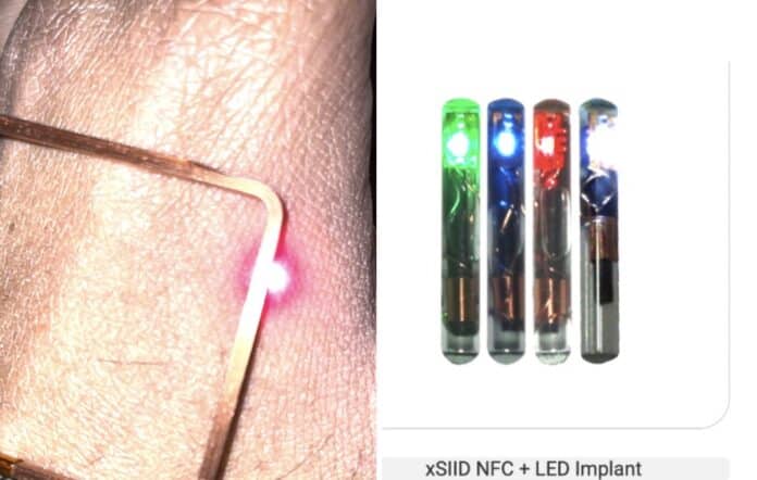 Implantable Chip Design for Secure Data Storage inside Body