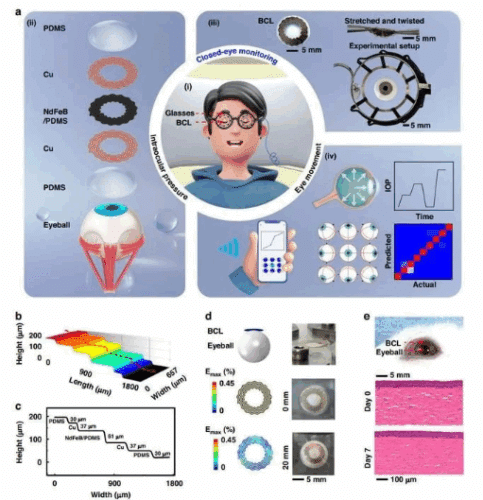 Smart Lens Enables Non-Invasive Eye Monitoring - Electronics For You ...