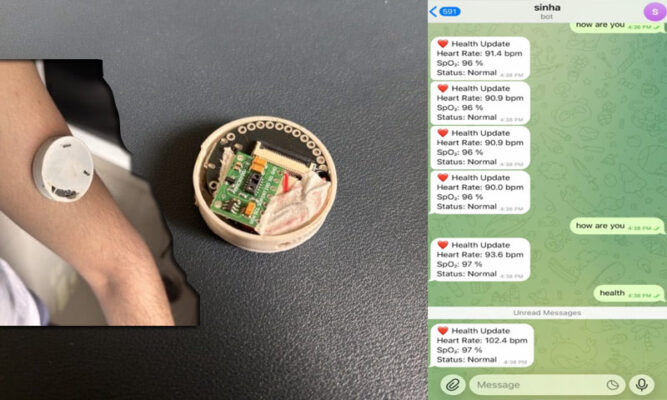 Wearable Health Monitoring Tag With Telegram Bot - Electronics For You ...