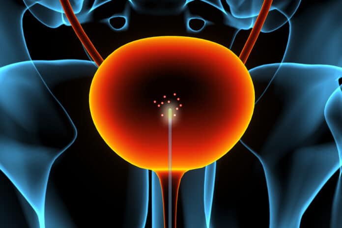 Nanotube Catheter Sensor Advances Detection - Electronics For You ...